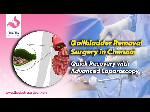 Laparoscopic vs Open Gallbladder Surgery: Best Option Guide