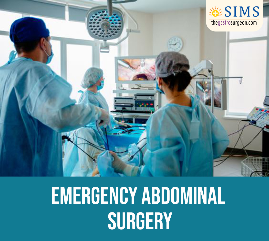 Abdominal Surgery | When It's Needed and What to Expect