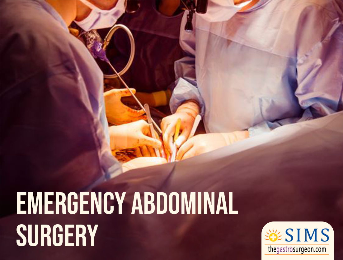 Abdominal Surgery | When It's Needed and What to Expect