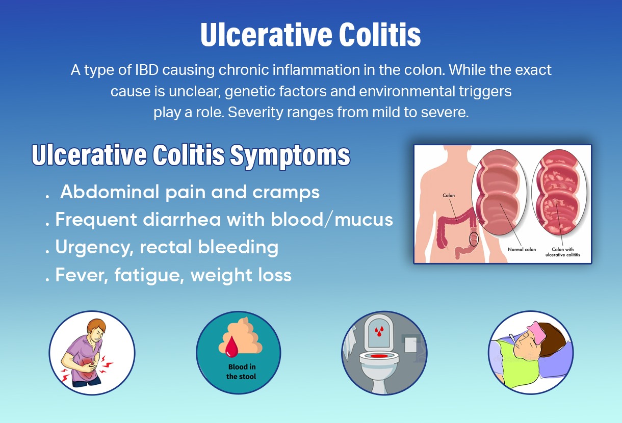 Ulcerative Colitis Symptoms and Treatment - Dr. Patta