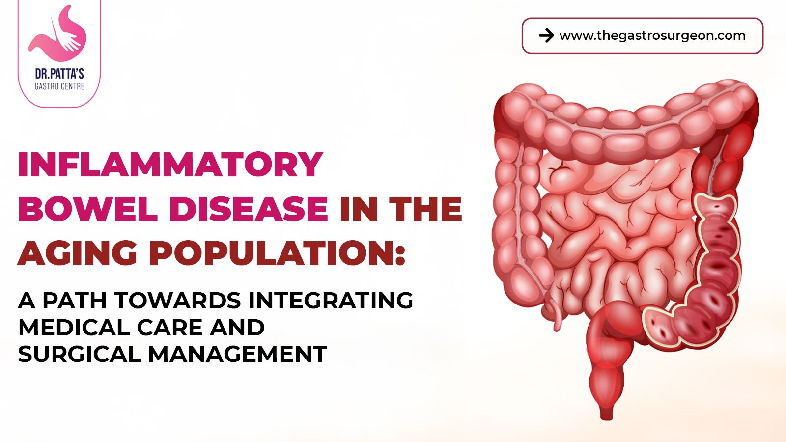IBD in Elderly Patients: Effective Management and Care